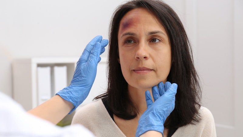Bruising & Contusions Injuries After Car Accidents